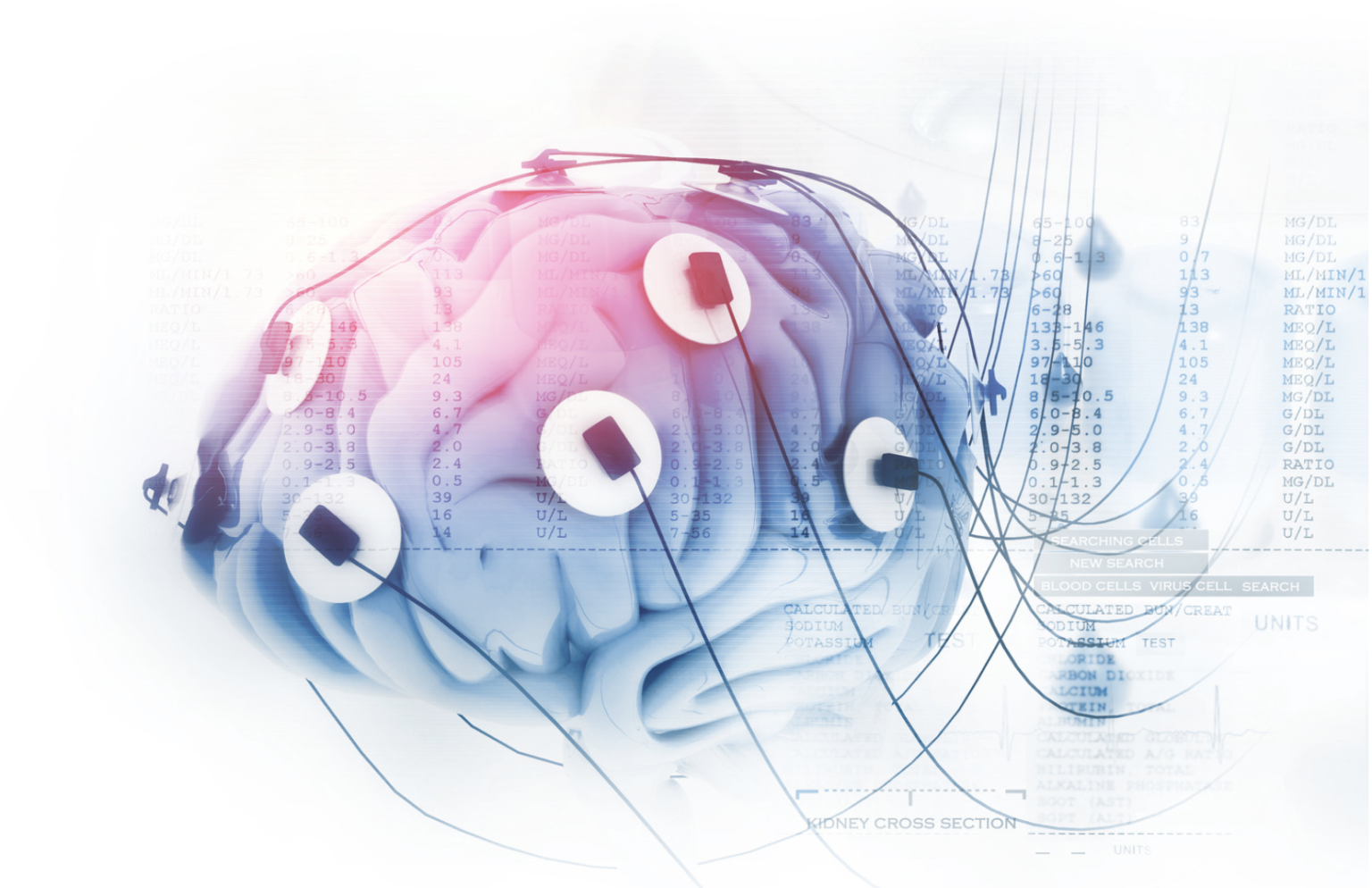 Brain Mapping - Central Jersey Neurofeedback